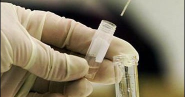 CDC Chief: Smallpox Still A Threat - CBS News