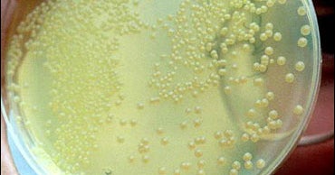 JBS Swift Expands Beef Recall - CBS News