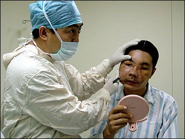 Amazing face transplants (GRAPHIC IMAGES)