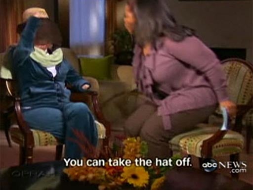 Chimp Victim Charla Nash