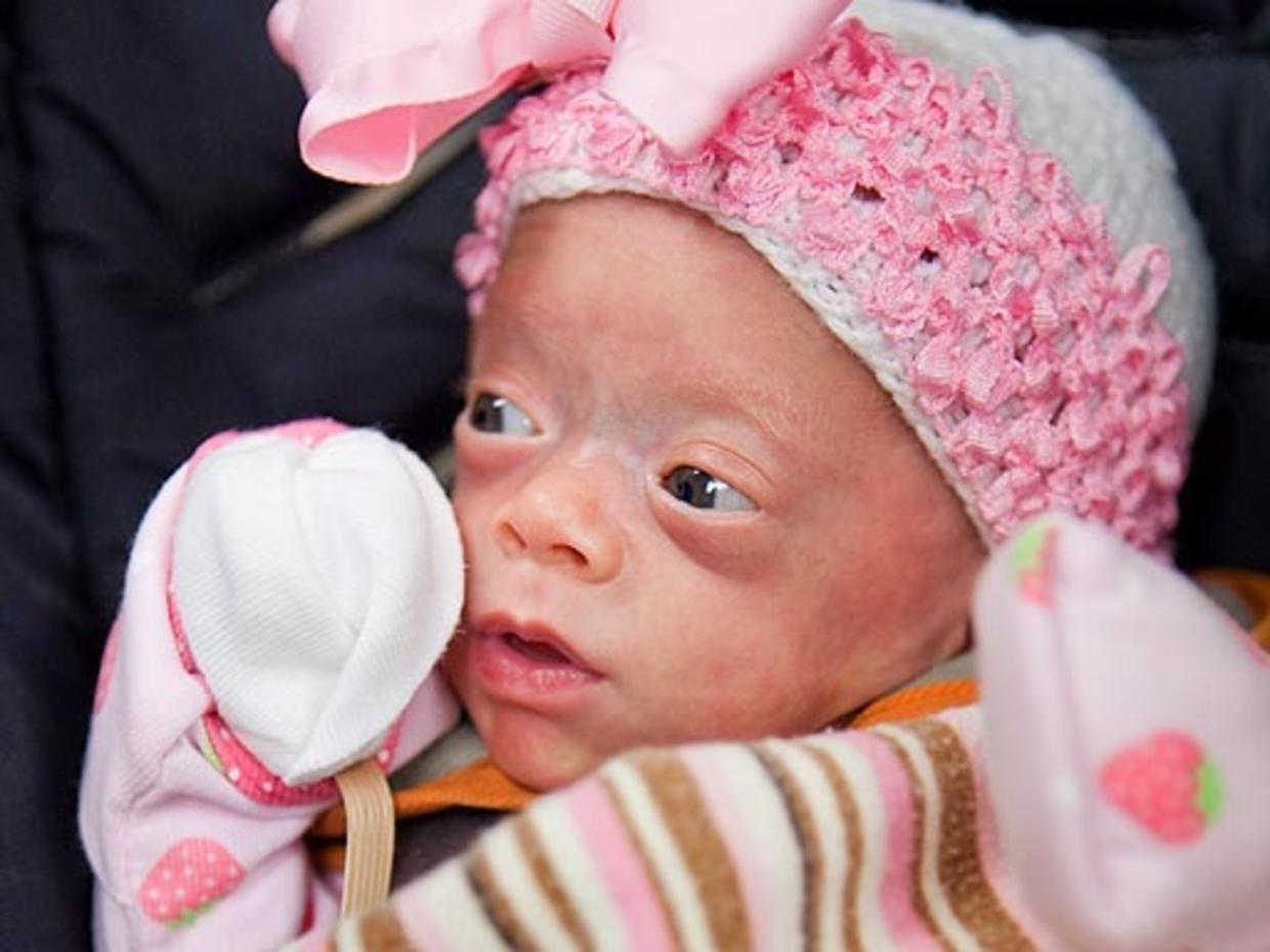 Josie Duggar Comes Home