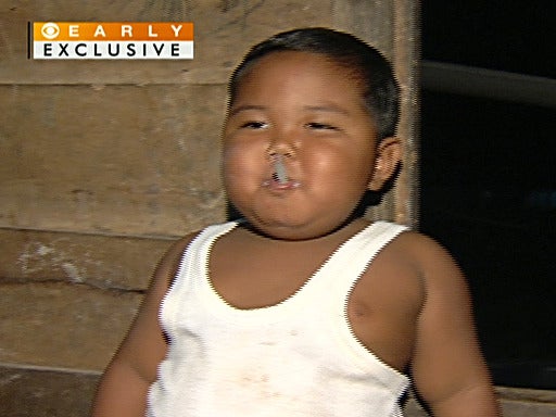 All About the Smoking Baby