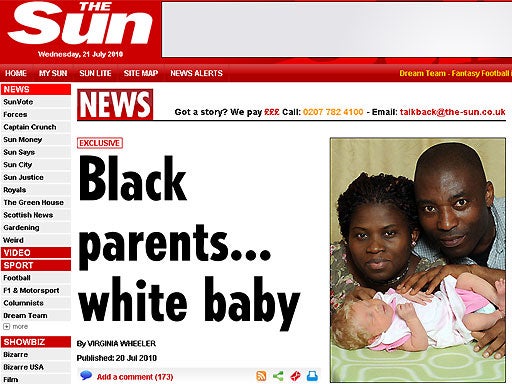 White Baby Shocks Black Parents: Medically Possible? - CBS News