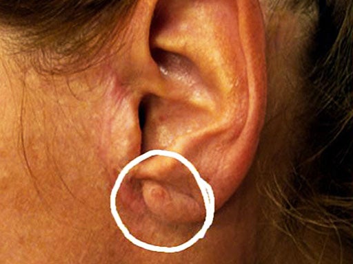 Plastic Surgery: 10 Secret Signs