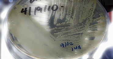 Alarming Uptick of Deadly Superbugs in Hospitals - CBS News