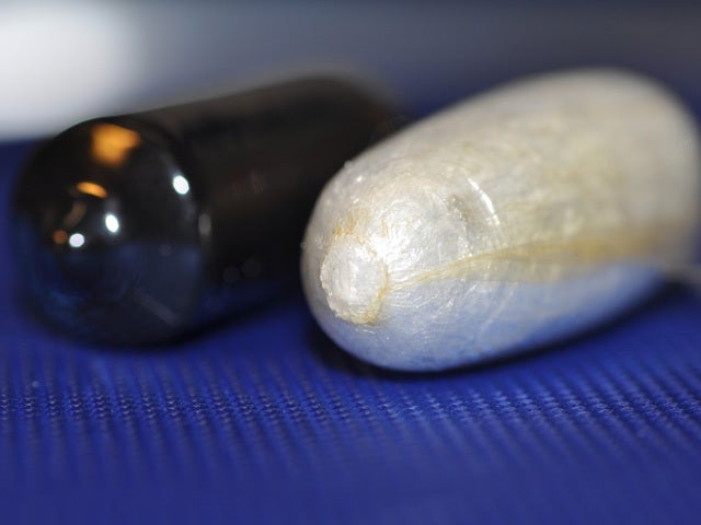 Busted! Drug mules caught on CT scans