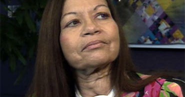 Voice Box Transplant Lets Woman Speak Again - CBS News