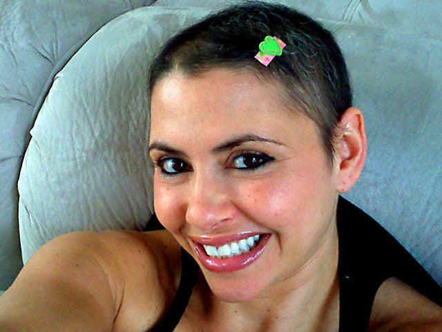 Bald and beautiful: Cancer patients' inspiring stories