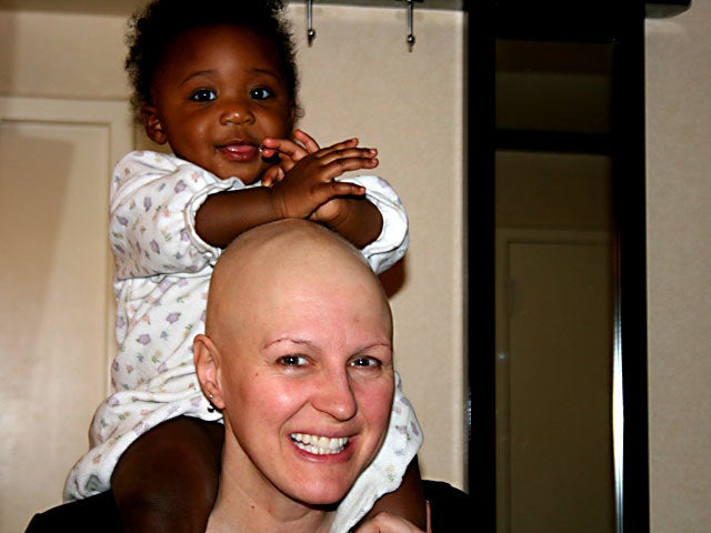 Bald and beautiful: Cancer patients' inspiring stories