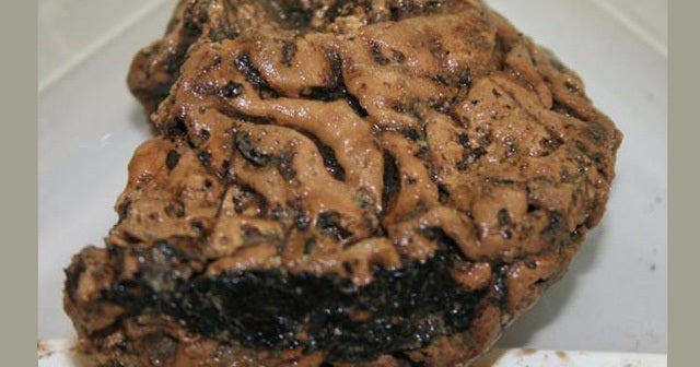 2,500 year-old preserved human brain discovered - CBS News