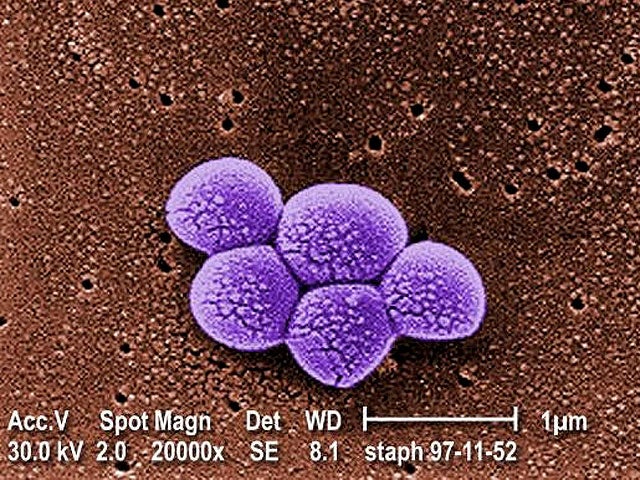 Deadly skin infection? 12 graphic photos that could save your life