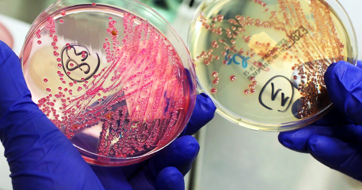 "Disease detectives" tracking Europe E.coli - CBS News