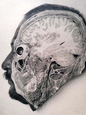 19th and 20th century psychiatry: 22 rare photos 19th and 20th century psychiatry: 22 rare photos