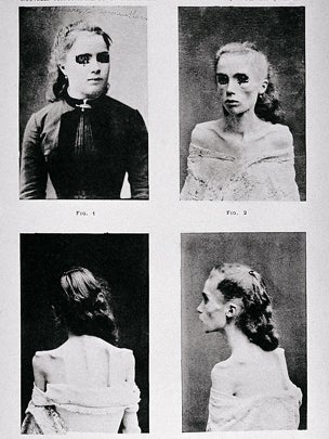 19th and 20th century psychiatry: 22 rare photos