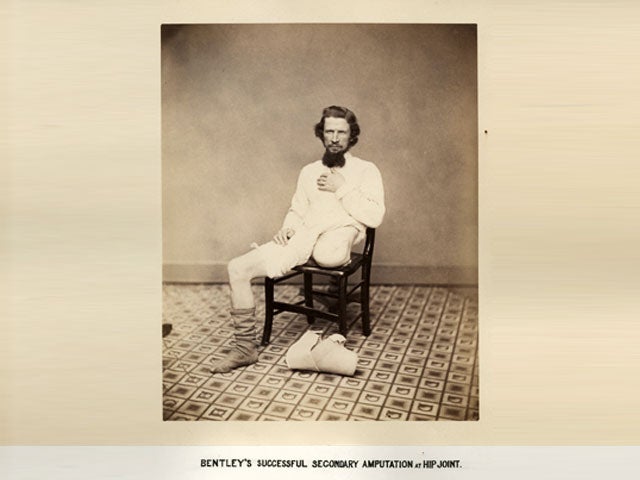 Civil War medicine: 37 pieces of history