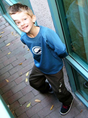 Proteus syndrome: The Elephant Man and beyond