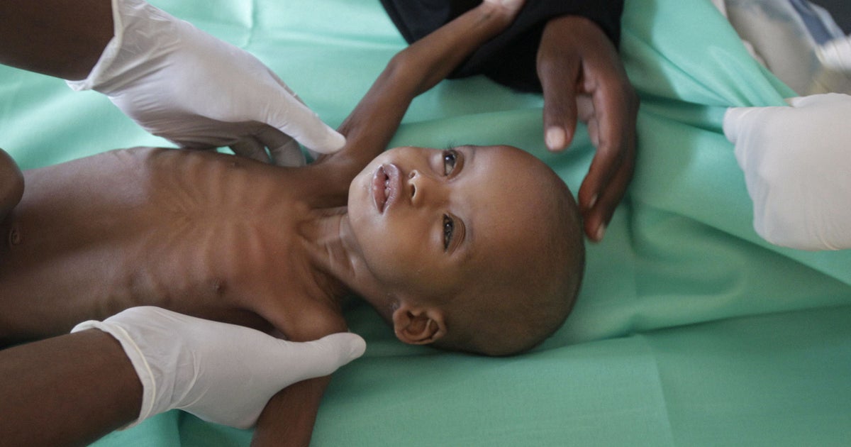Famine relief must "scale up" efforts: UNICEF - CBS News