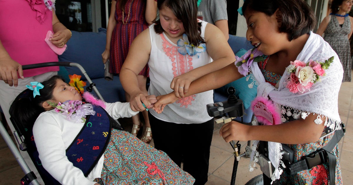 Mel Gibson at party for formerly conjoined twins