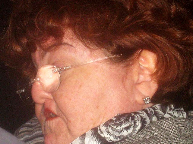 14 celebrity noses: Whose schnoz do you share?