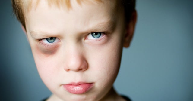 Serious injuries from child abuse on rise, especially in infants - CBS News