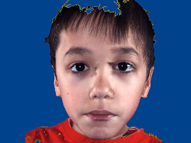 Is it autism? Facial features that show disorder