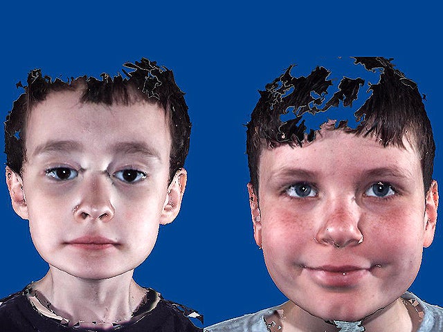 Is it autism? Facial features that show disorder