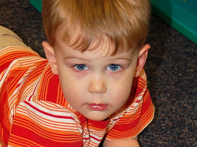 Is it autism? Facial features that show disorder