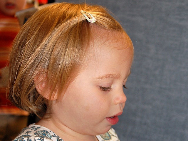 Is it autism? Facial features that show disorder