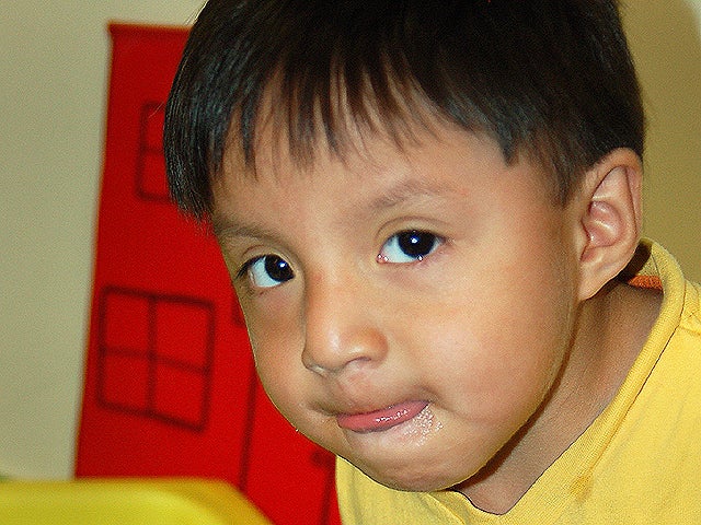 Is it autism? Facial features that show disorder