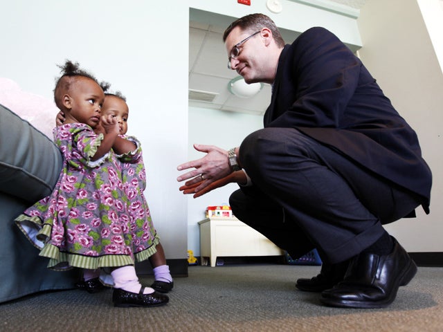 Conjoined twins Maria & Teresa Tapia: Before and after