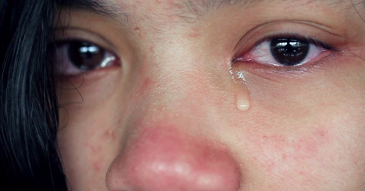 "Losers" is a powerful video about bullying that makes you think - CBS News