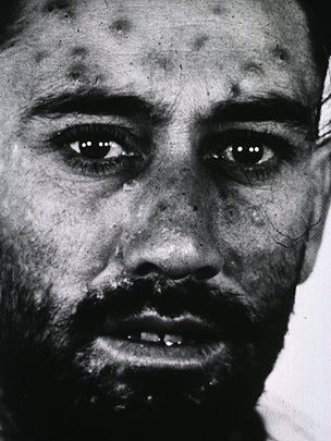 Dangerous sex: 27 vintage STD posters