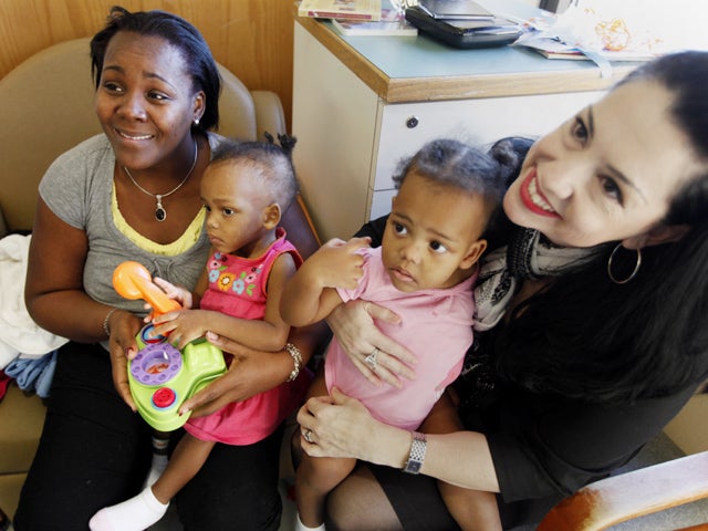Conjoined twins Maria & Teresa Tapia: Before and after