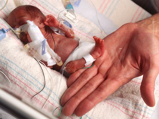 World's tiniest babies: How are they now?