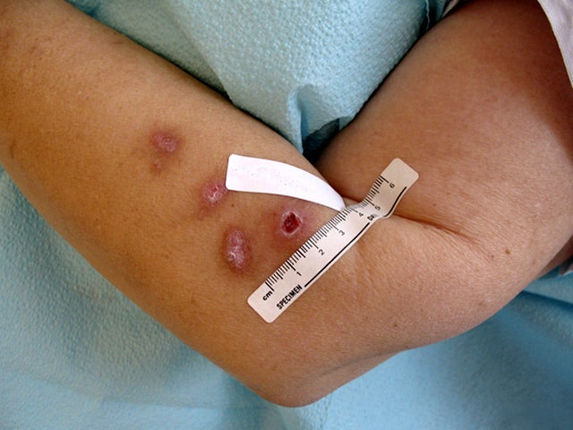 9 uncommon skin conditions