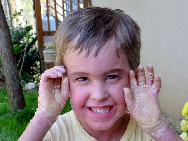 9 uncommon skin conditions 9 uncommon skin conditions