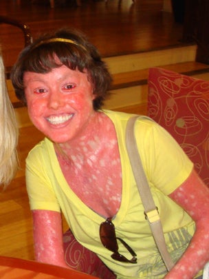 9 uncommon skin conditions 9 uncommon skin conditions