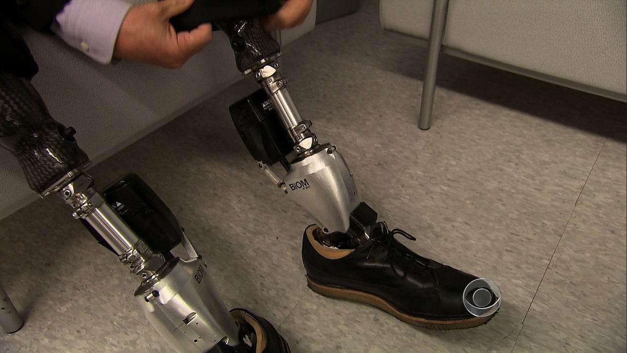 Bionic men: Amputees say next-generation prosthetics respond like the ...
