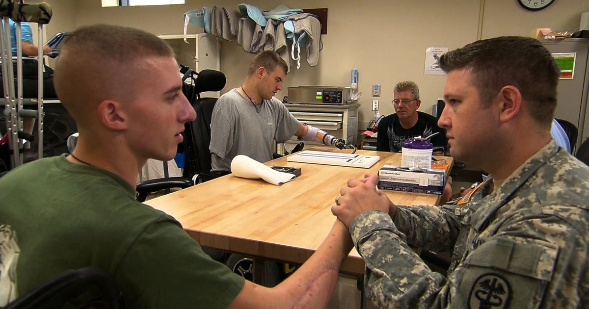 As more U.S. soldiers lose limbs in Afghanistan, doubts about a war ...