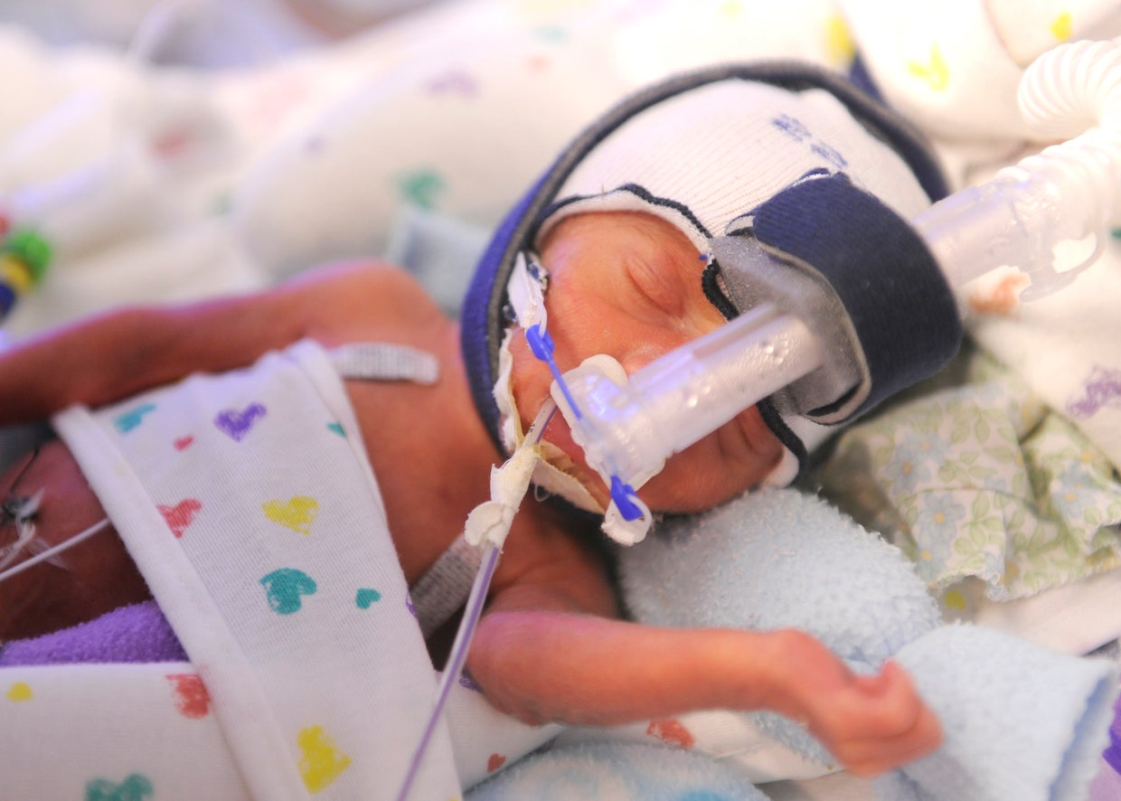 Texas family welcomes quintuplets