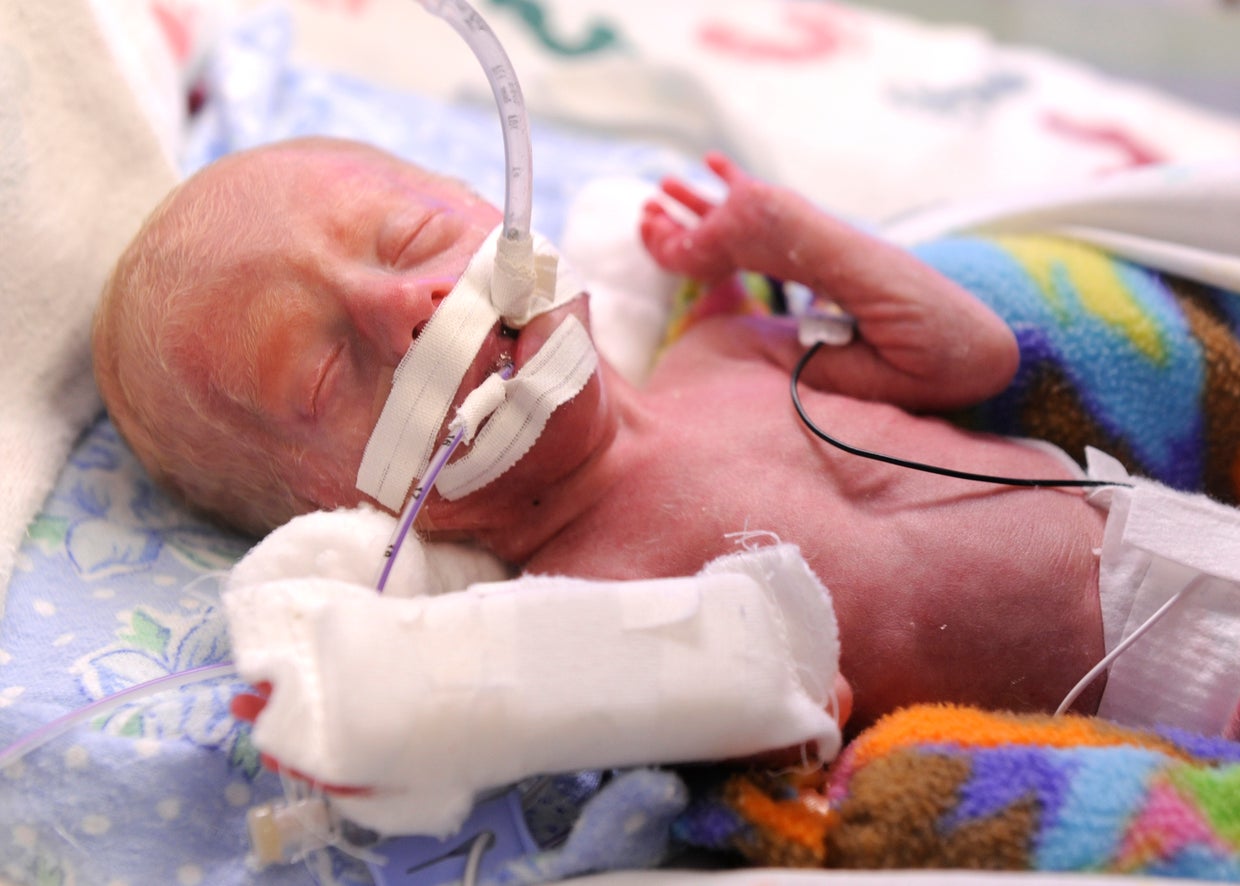 Texas family welcomes quintuplets