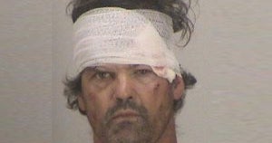 Weed whacker attack injures woman next door, assailant hurt, too, say ...