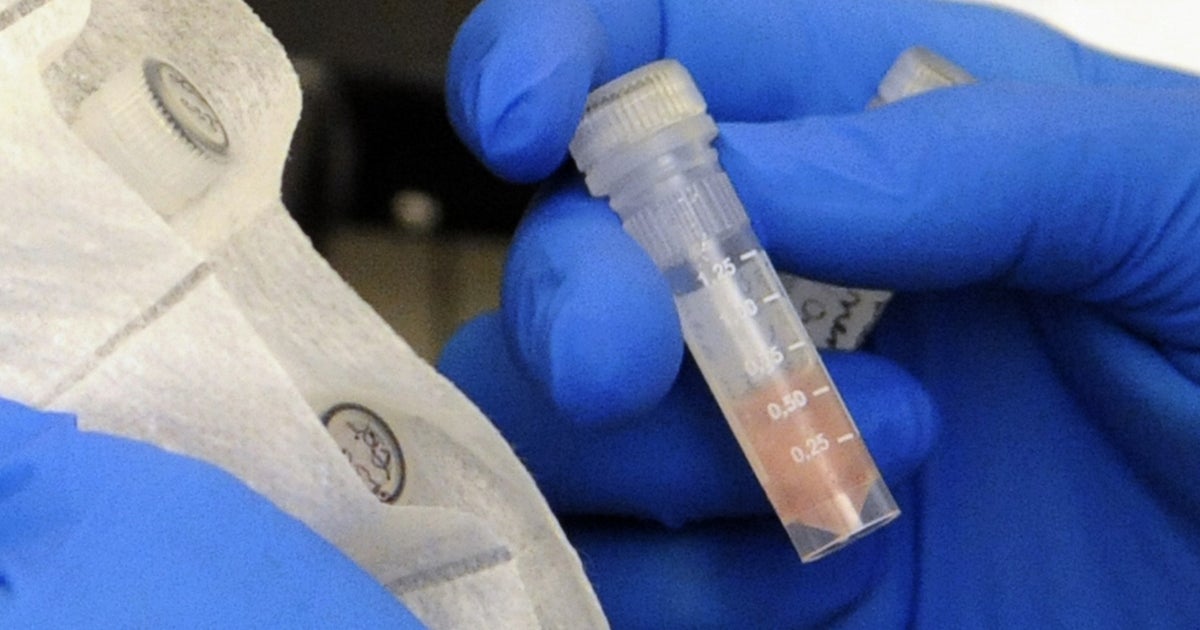 CDC: 15th meningitis death reported - CBS News