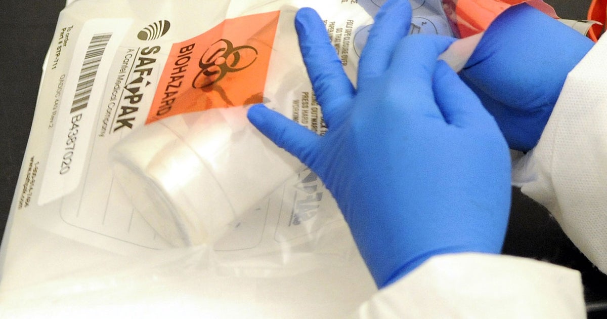 Meningitis death toll rises, 14 more infected - CBS News