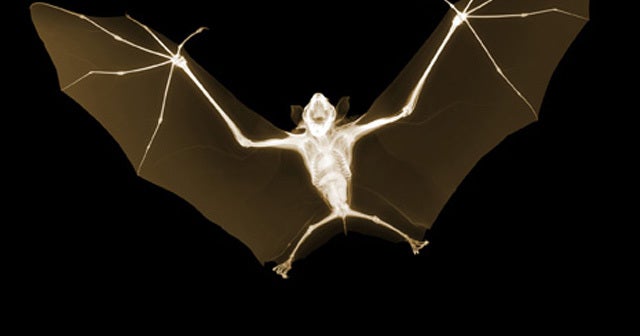 Incredible x-ray art