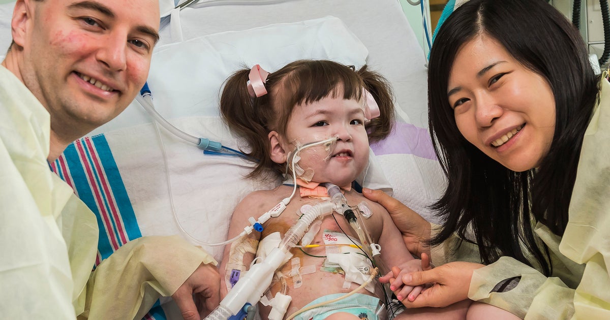 Two-year-old "pioneer" of stem cell trachea transplant dies - CBS News