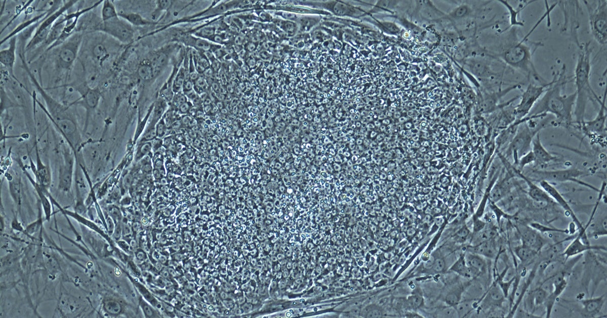 Scientists successfully clone human stem cells via skin cells - CBS News
