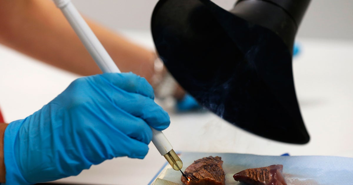 New "intelligent" knife can tell cancerous tumor from healthy tissue ...