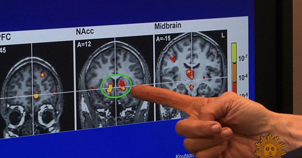 The science behind pleasure-seeking - CBS News