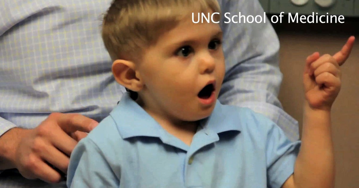 Toddler with auditory brain stem implant says first words - CBS News